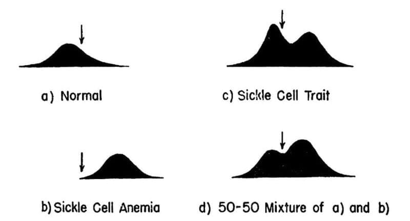 Sickle Cell Anemia was molecularly characterized in 1949 using a revolutionary new technique ...